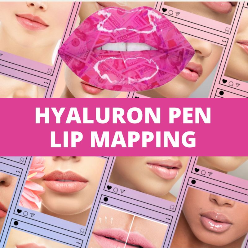 Hyaluron pen Lip Mapping Ebook lip fillers work - kissklinic – Kiss Klinic