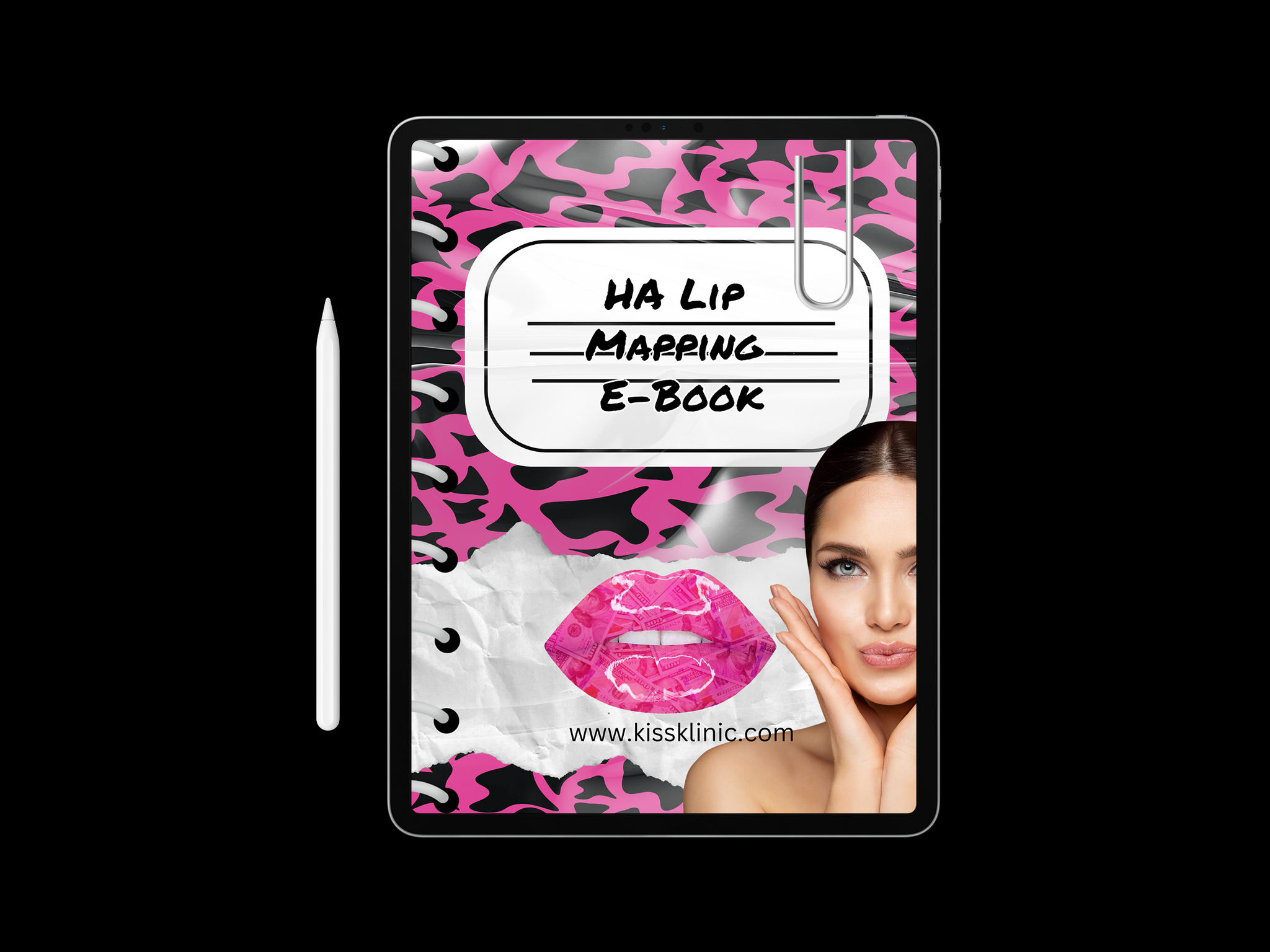 Hyaluron pen Lip Mapping Ebook lip fillers work - kissklinic – Kiss Klinic